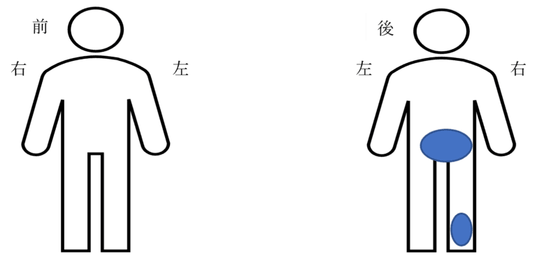 本日の治療症例紹介 CASE-No.113｜ILC国際腰痛クリニック（大阪）コラム | ILC国際腰痛クリニック【公式サイト】